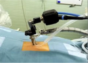 内視鏡治療について（FESS,PEL,PELD） | 腰・首・頭の治療なら日進市にある中京スパインクリニックへ